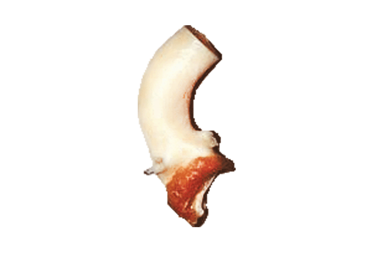 CardioGraft® Ascending Aorta Conduit (non-valved) | LifeNet Health
