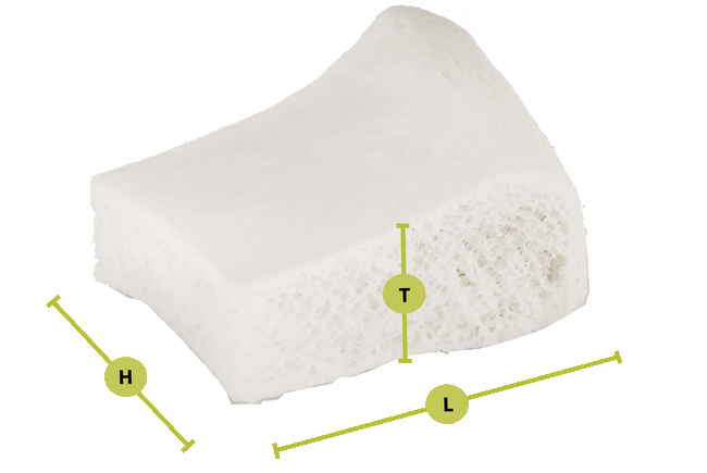 MatriGraft® Iliac Crest Wedge | LifeNet Health